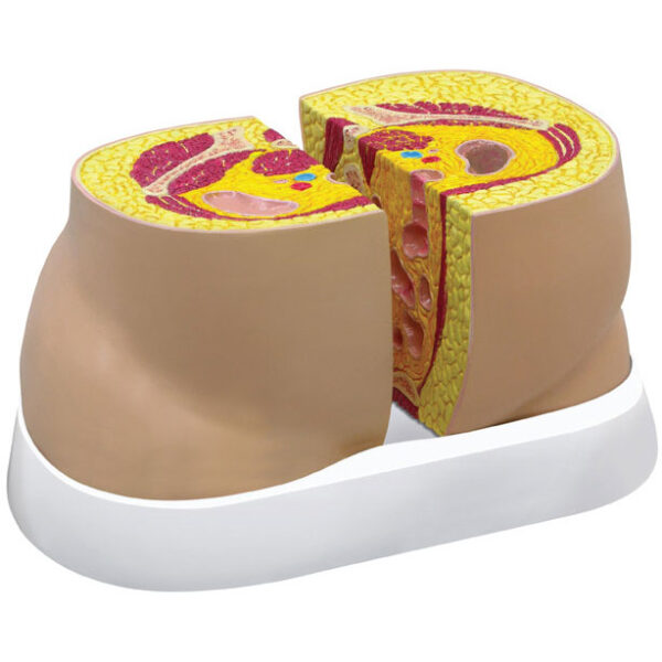 Skinfold Calipers: Choose The Industry Standard Harpenden