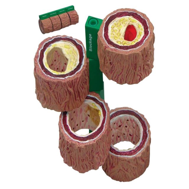 Artery Anatomical Model - 4-part Model | HaB Direct