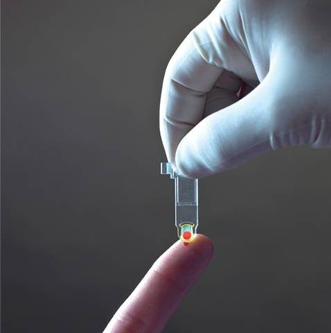 Hemo Control Microcuvette | HaB Direct