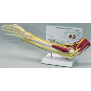 Muscled Elbow Anatomical Model | Anatomical Model w/ Muscle - HaB Direct