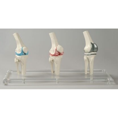 Knee Implant Model, Set of 3 Joints | HaB Direct