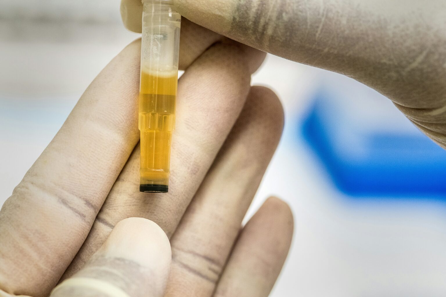 Urology Awareness Month: Why Urine Specific Gravity Matters | HaB Direct